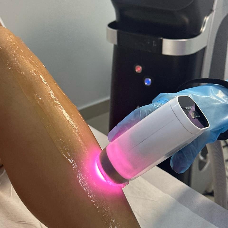 WhyDermaLaser | Derma Laser
